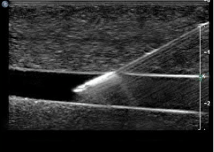 Vascular Access/PICC Line – Lumify Store